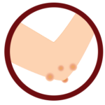 Sitosterolemia : LearnYourLipids